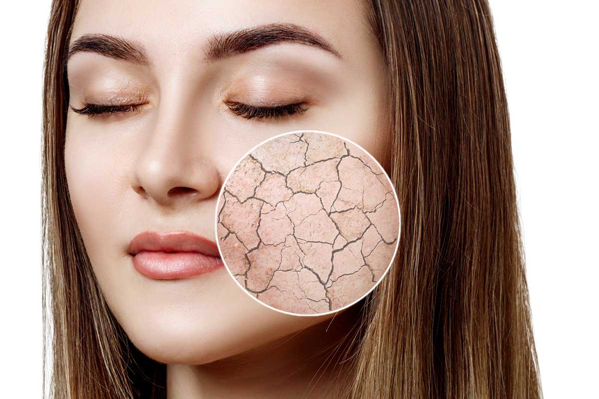 Comment prendre soin d'une peau sèche ? - MagFeminin.com